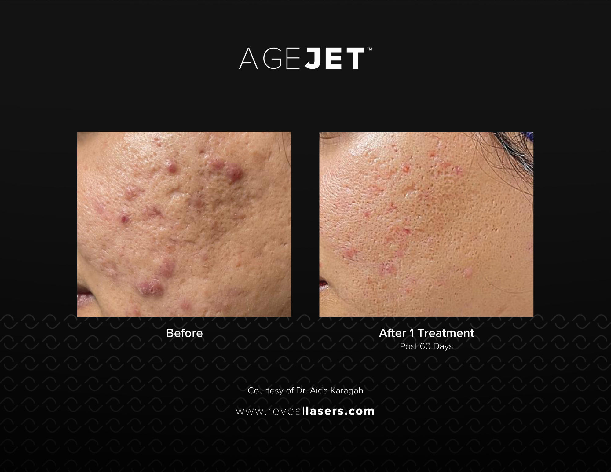 Agejet – Juve Integrative Medicine & Wellness
